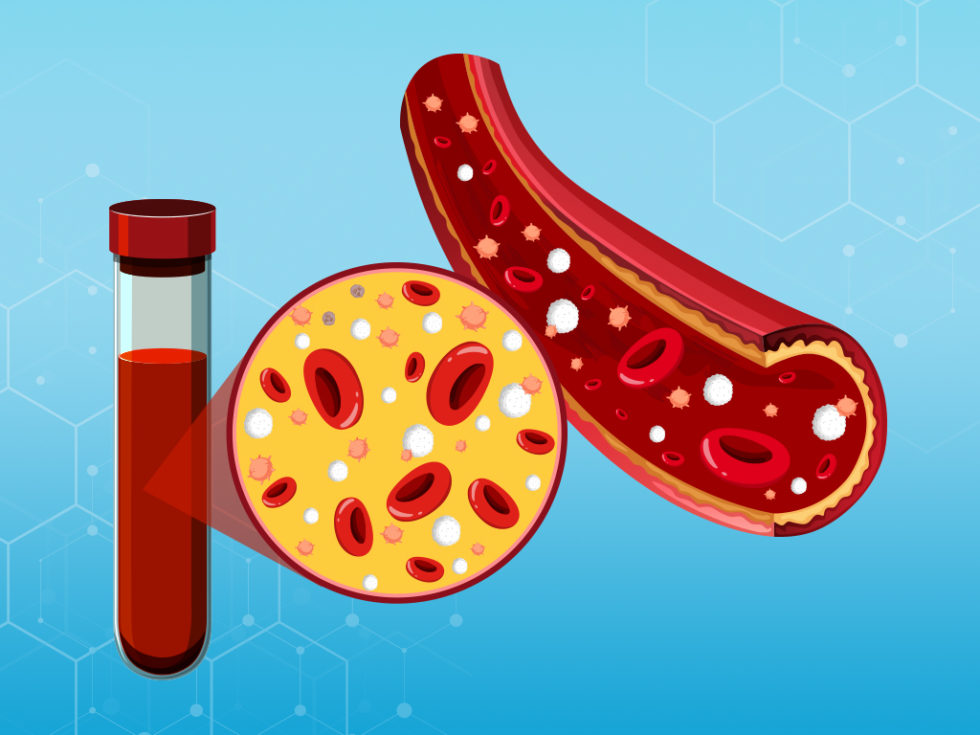 Leucocyte-Poor vs. Leucocyte-Rich PRP Therapies - Which is Better ...